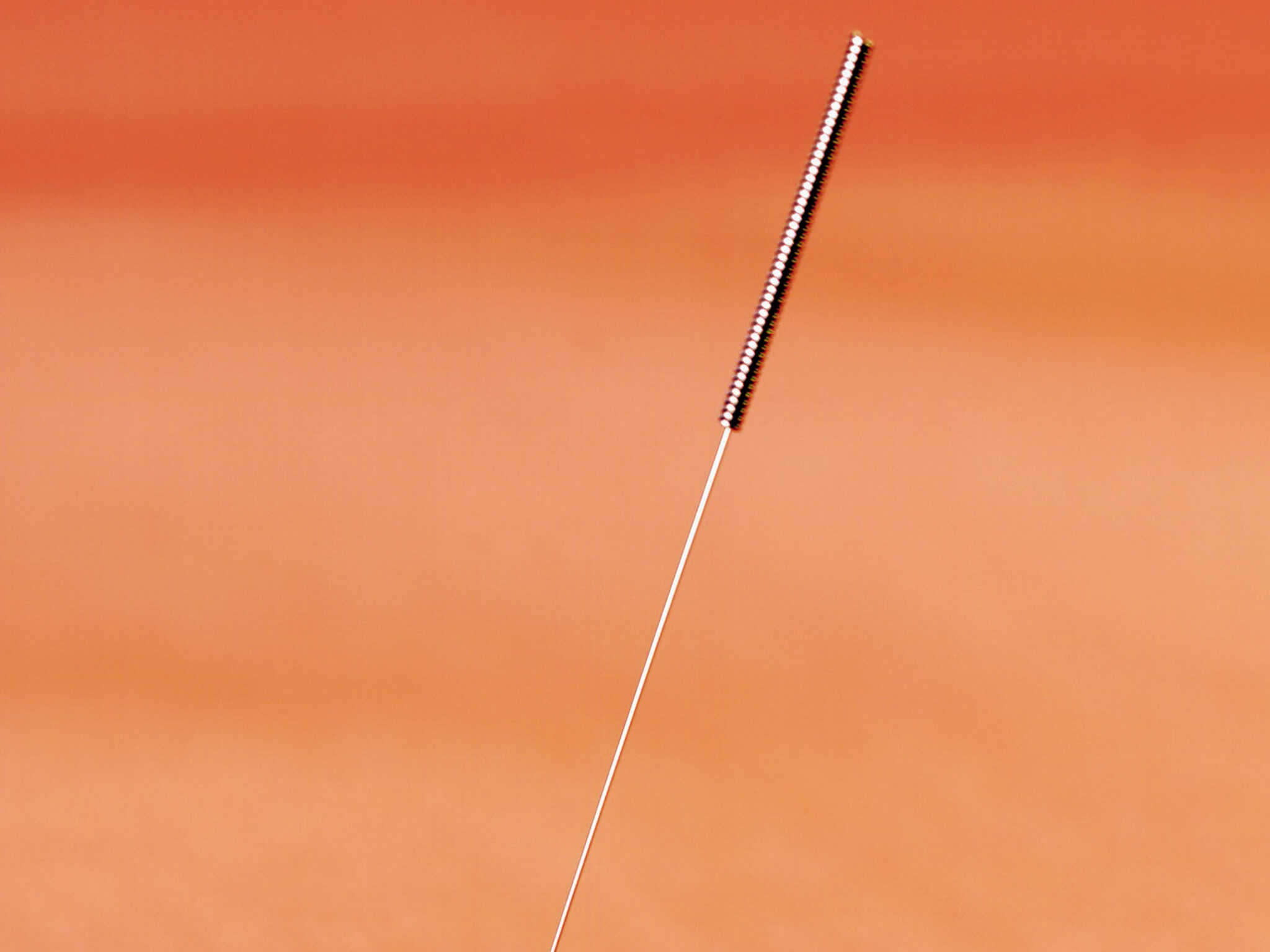 Classes - Sun Acupuncture